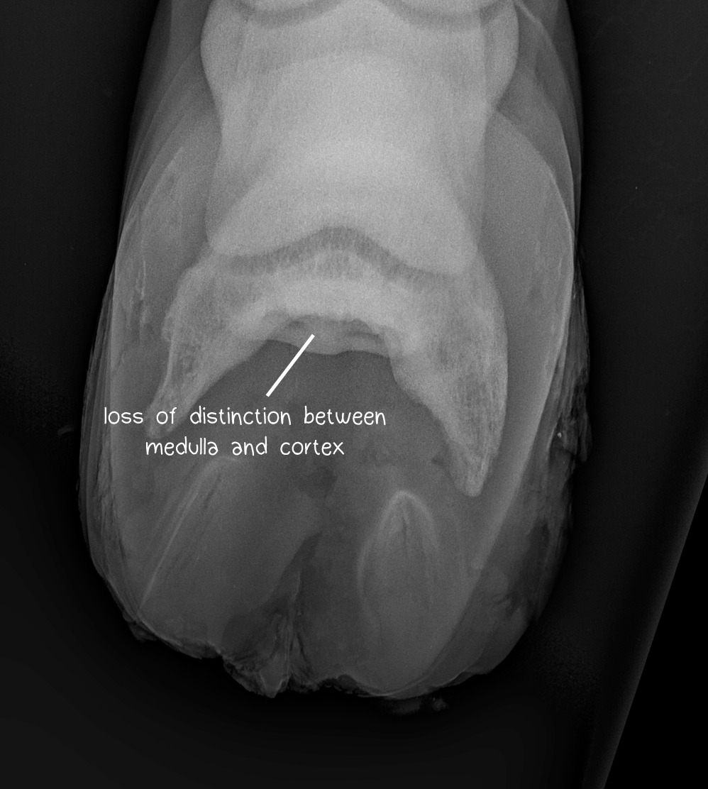 Navicular Syndrome - Pathology and Ponies