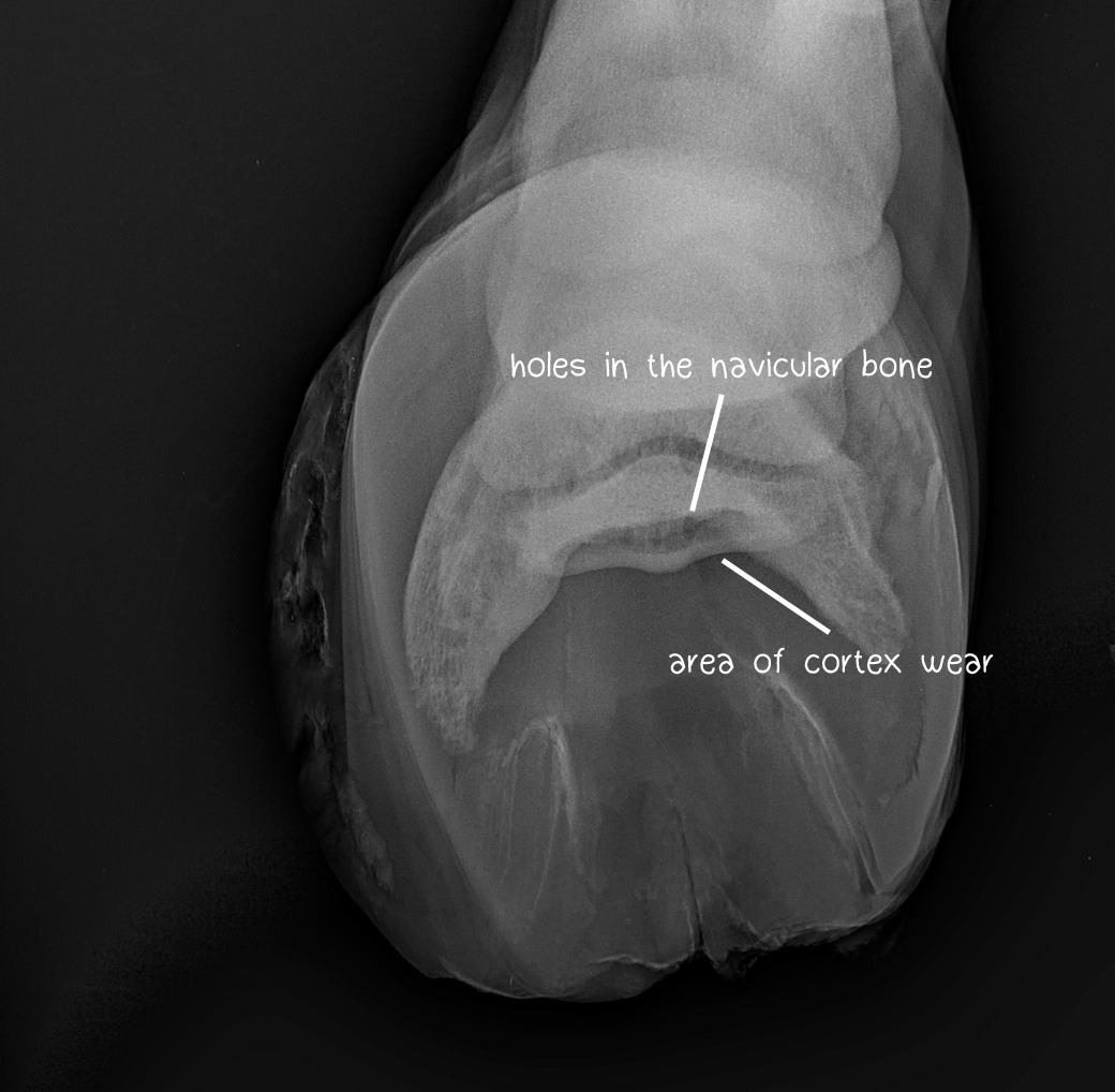 Navicular Syndrome - Pathology and Ponies