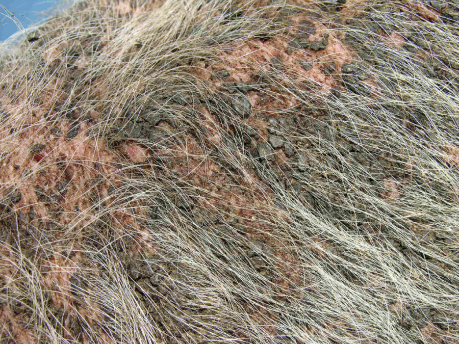 Greasy Pig Disease - Pathology and Ponies