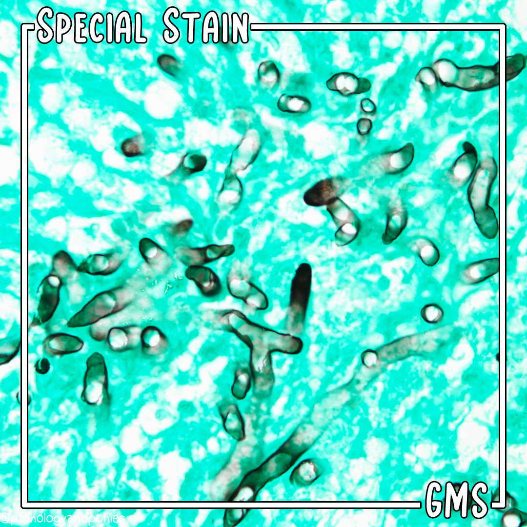 Special Stain: GMS - Pathology and Ponies