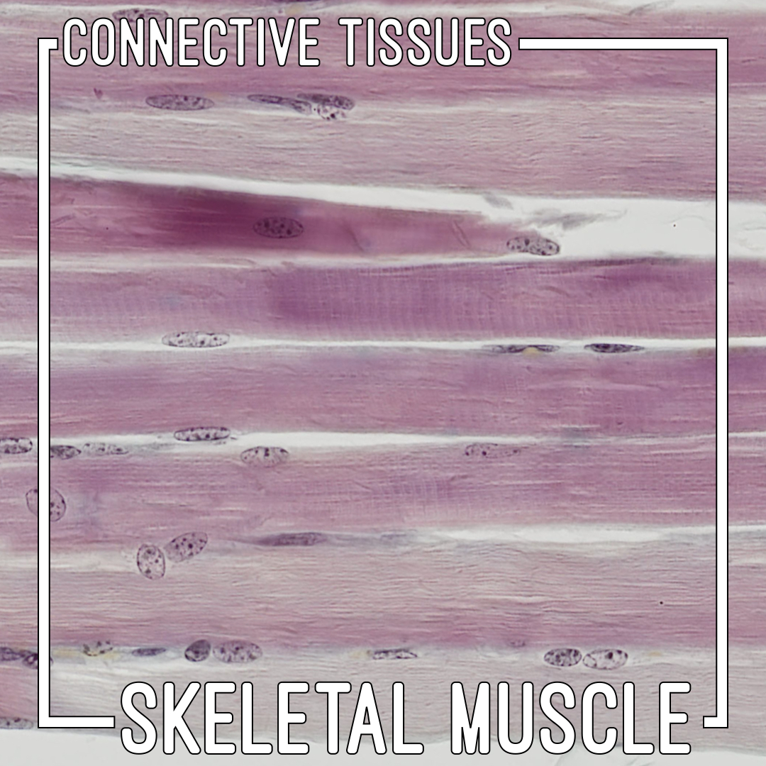 Skeletal Muscle - Pathology and Ponies