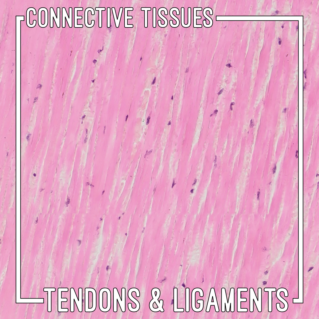 Tendons and Ligaments - Pathology and Ponies