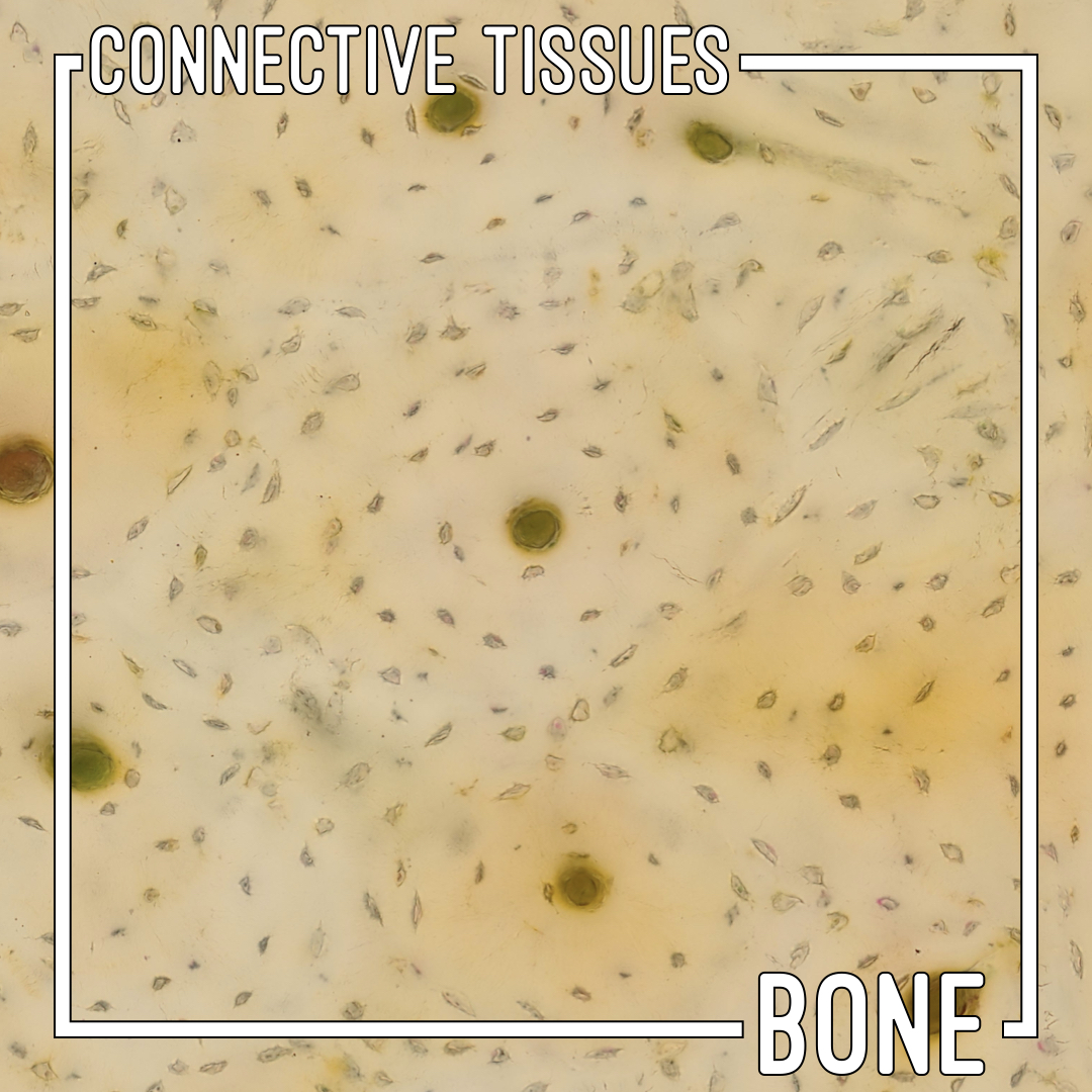 Bone - Pathology and Ponies