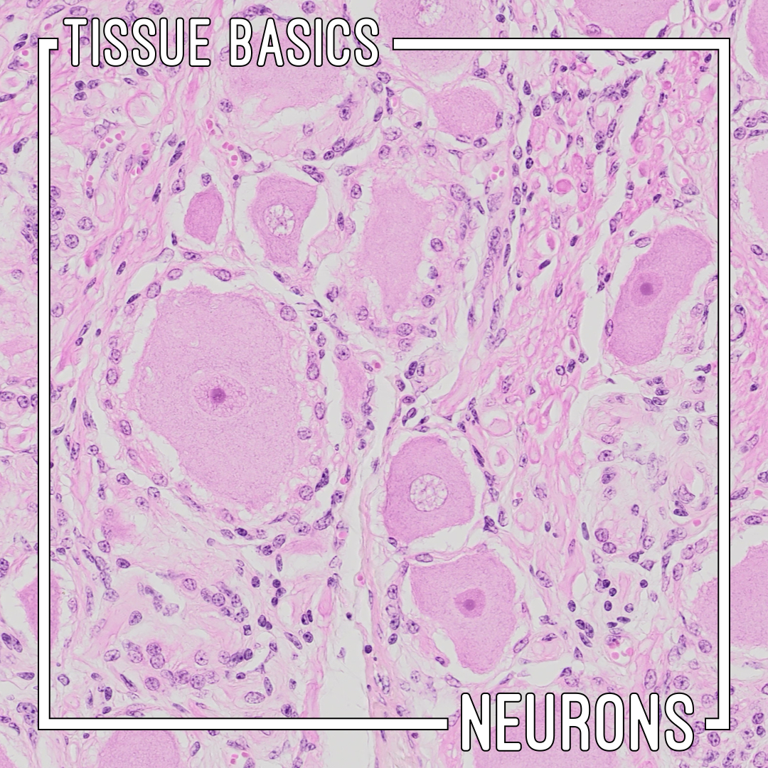 Neurons - Pathology and Ponies